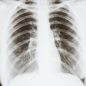 Tu stii cati ani au plamanii tai? | avantaje.ro